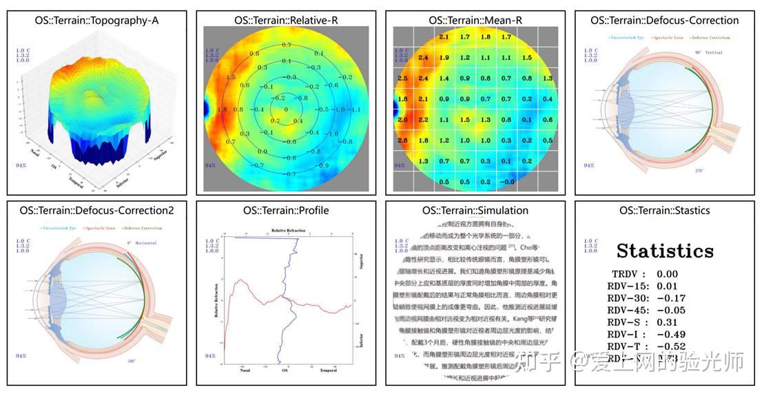 MRT检测是什么？ - 知乎