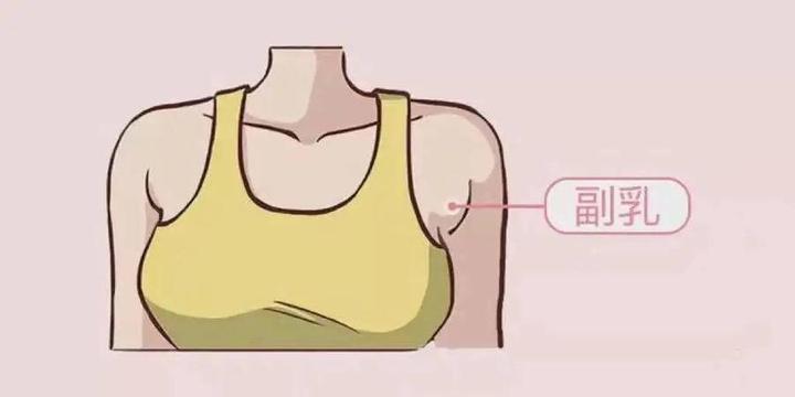 胸部下垂、外扩、有副乳怎么办?如何拥有 完美”胸部? 知乎