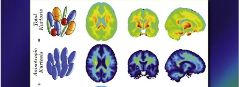引用分10.6，中科院医学1区Top的神经科学领域旗舰刊 NeuroImage - 知乎