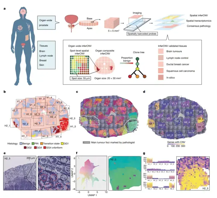 利用空间转录组学揭示良性和恶性组织中的细胞拷贝数变异 - 知乎